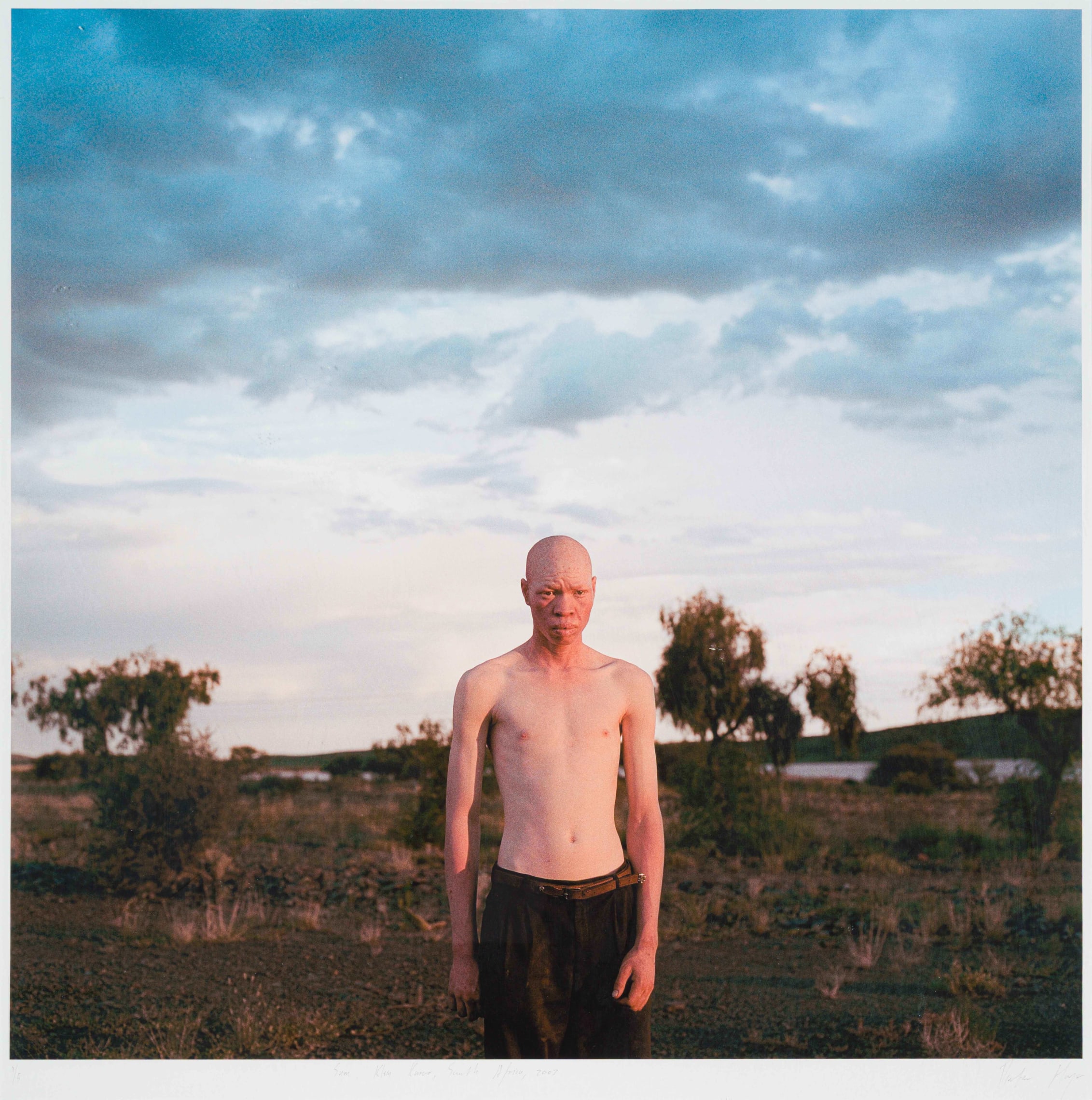 Sam, Klein Karoo, South Africa, 2007 by Pieter Hugo | Strauss & Co
